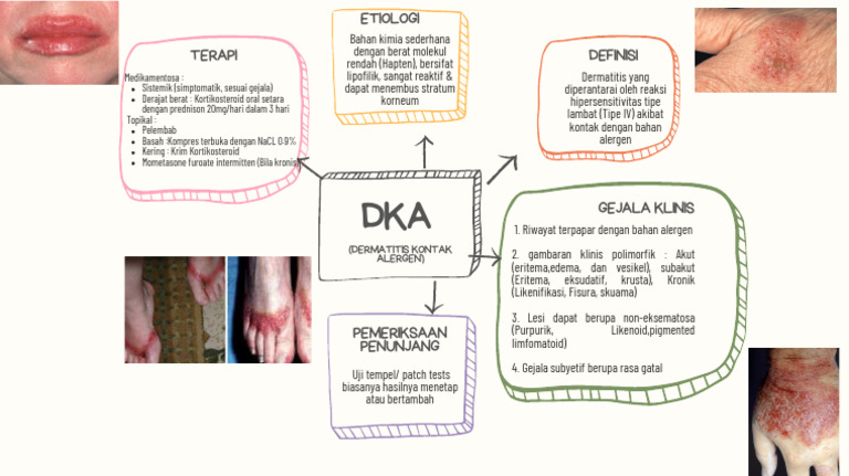 DKA Mind Map Fix | PDF