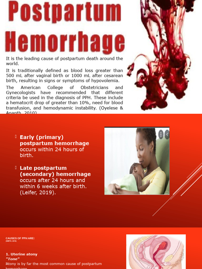 Postpartum Hemorrhage (PPH) | PDF | Childbirth | Uterus