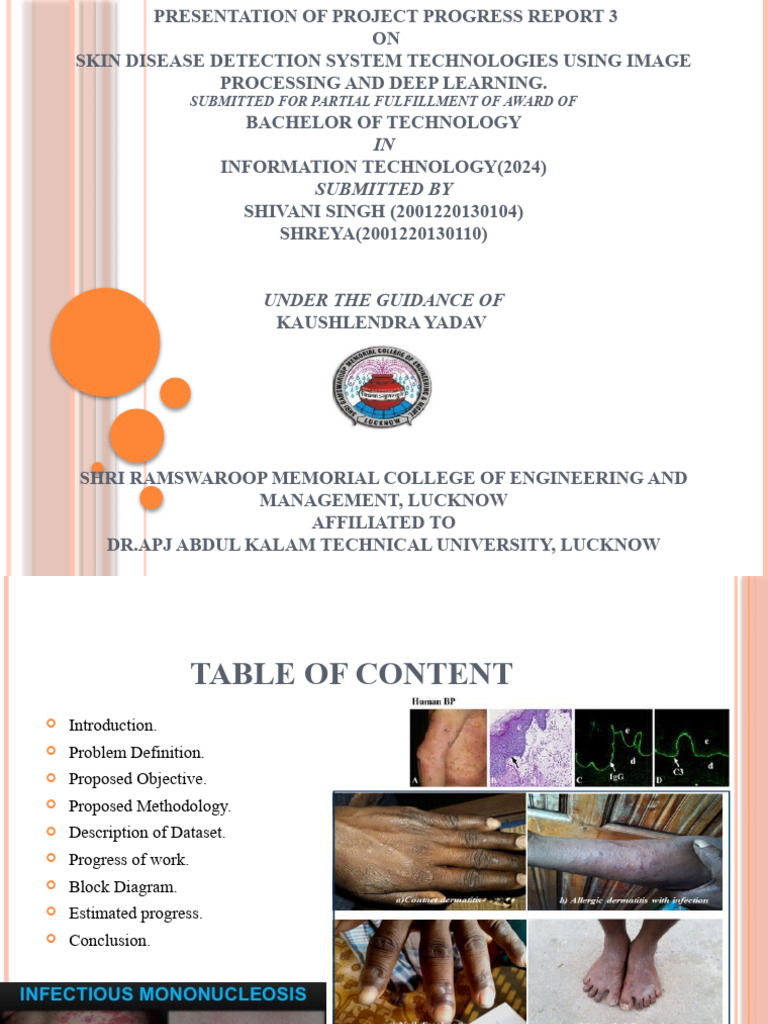 Presentation of Project Synopsis | PDF | Dermatology | Machine Learning