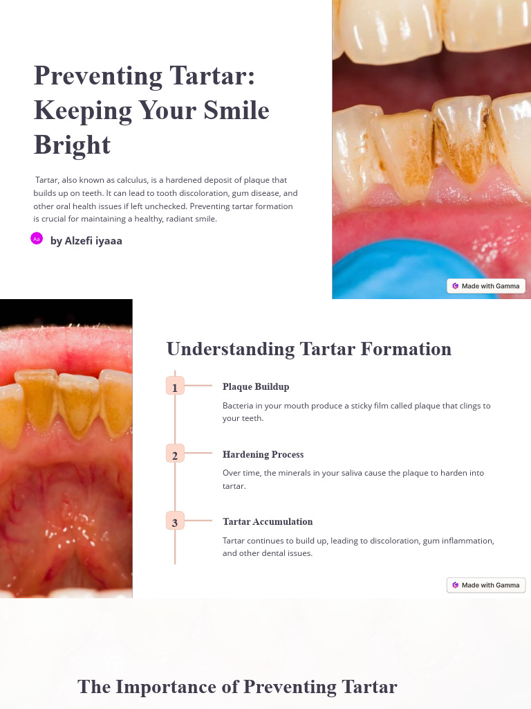 Preventing Tartar Keeping Your Smile Bright | Download Free PDF | Oral ...