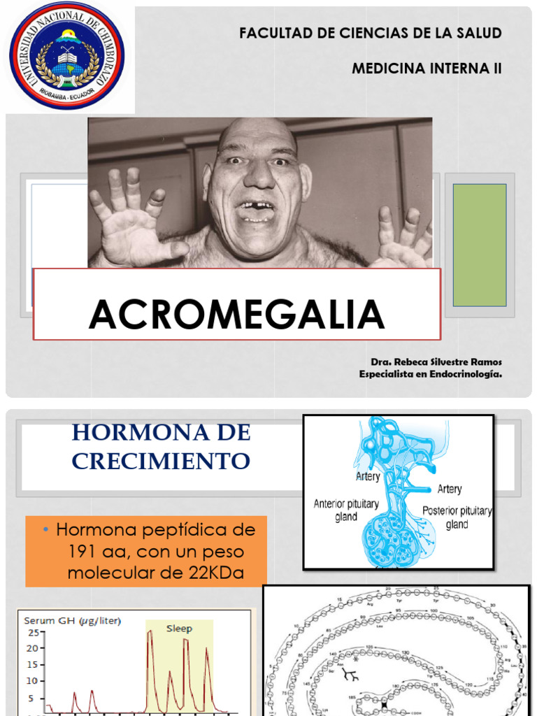 Acromegalia: Diagnóstico y Tratamiento | PDF | Receptor (Bioquímica ...