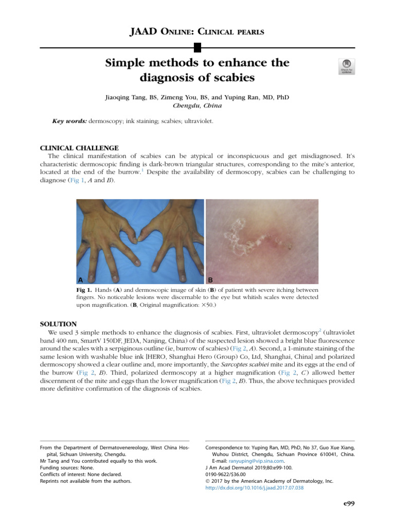 Simple methods to enhance the diagnosis of scabies | PDF | Clinical ...