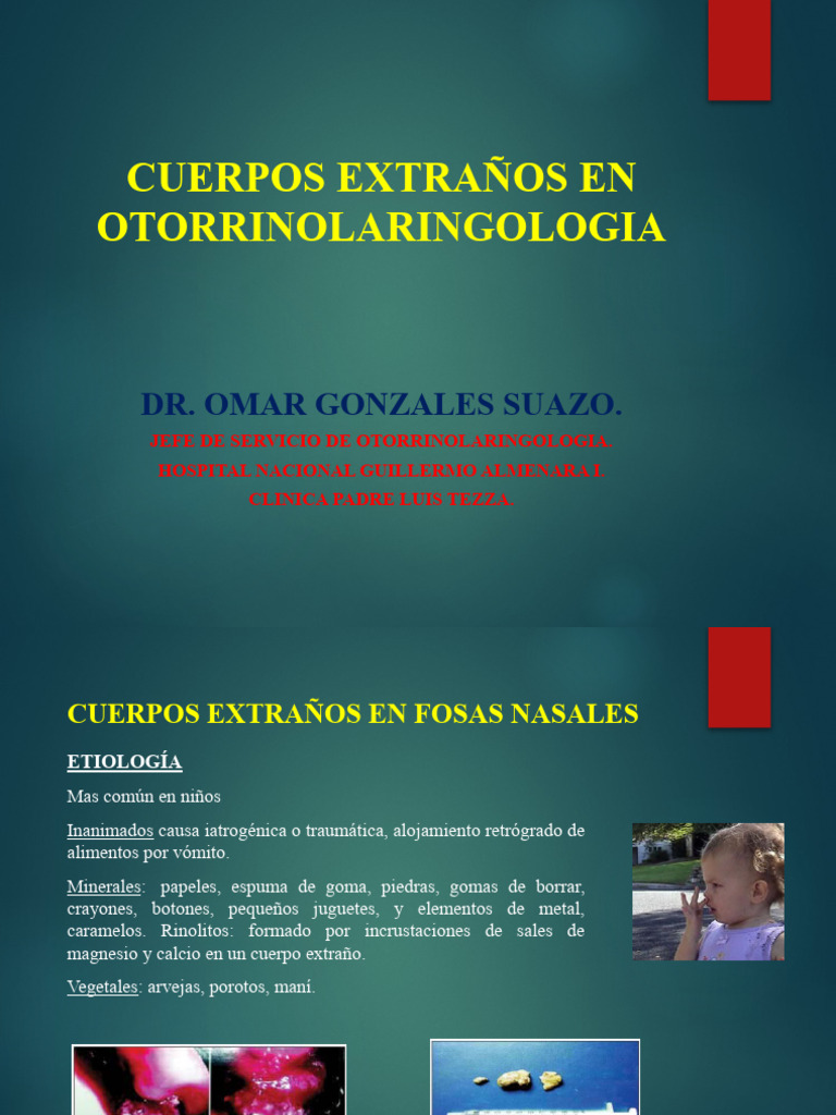 cuerposextraosenviasrespiratoriasdr-170411154052 | PDF | Medicina CLINICA | Enfermedades y ...