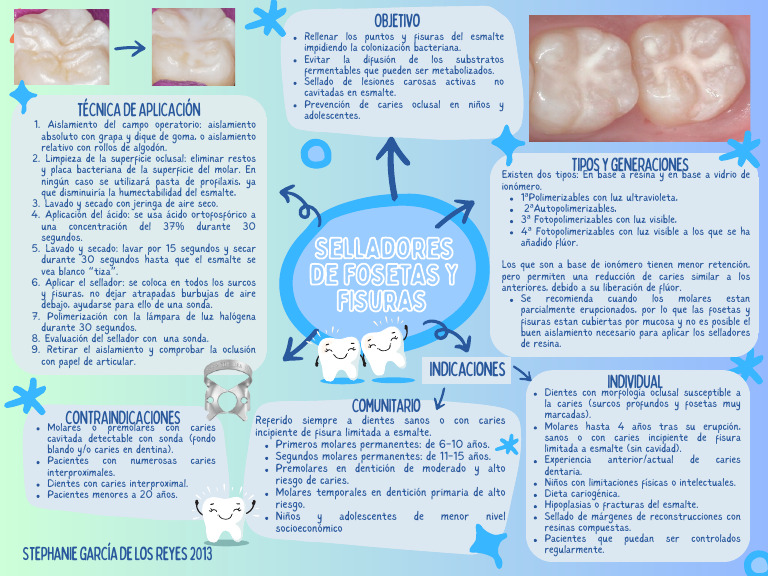 Act. Selladores de Fosetas y Fisuras | PDF | Diente | Odontología