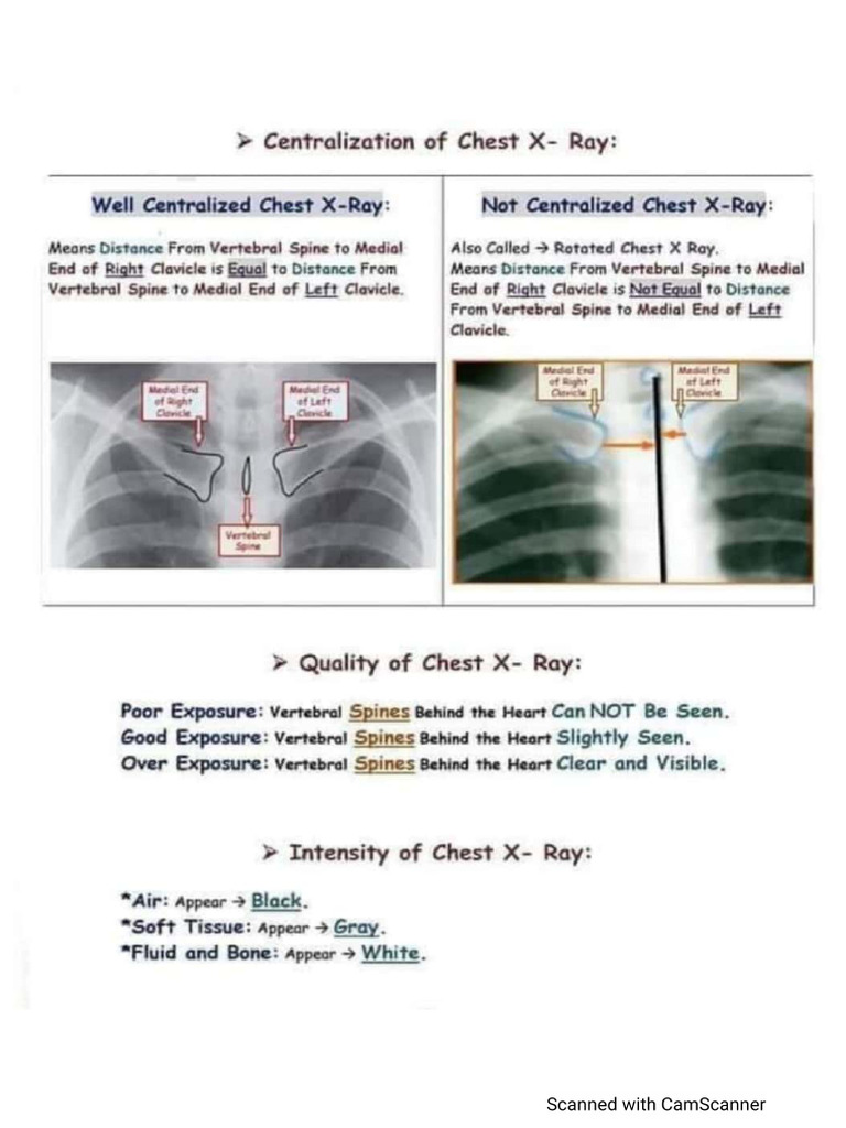 CXR Interpretation | PDF