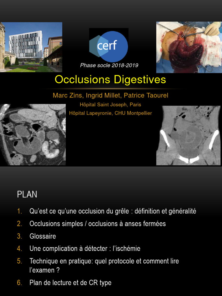 13 Occlusion Du Grêle Phase Socle EH MZ | PDF | Appareil digestif ...
