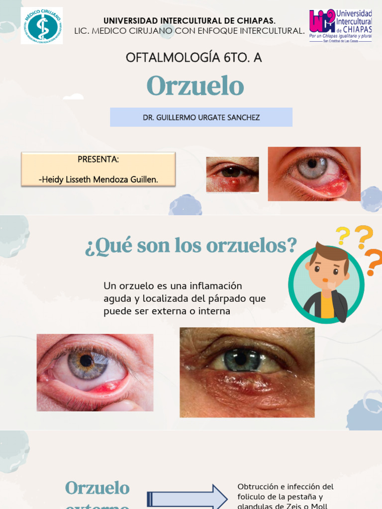 Orzuelo: Diagnóstico y Tratamiento | PDF | Epidemiología | Medicina