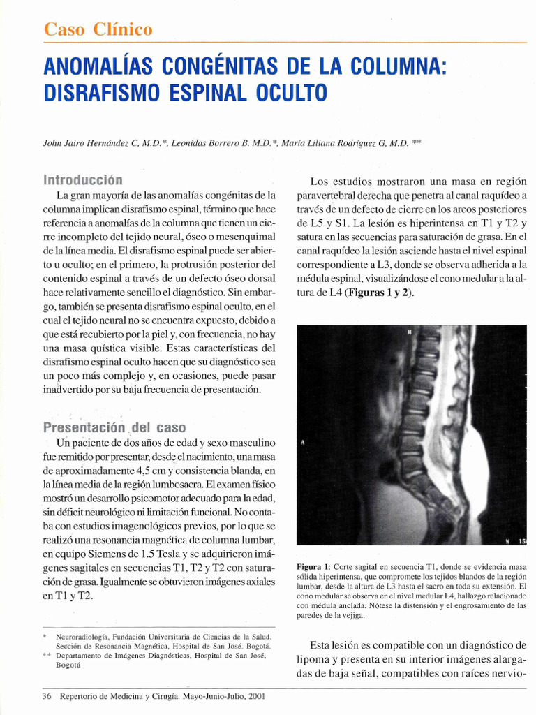 Anomalías Congénitas de La Columna: Disrafismo Espinal Oculto | PDF ...