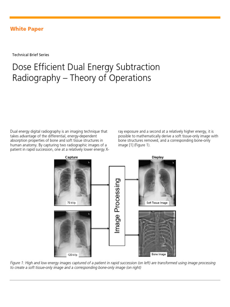 DRX Evolution | PDF | Radiography | X Ray