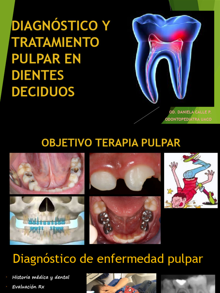 Diagnãstico y Tratamiento Pulpar en Dientes Deciduos | PDF | Medicina ...