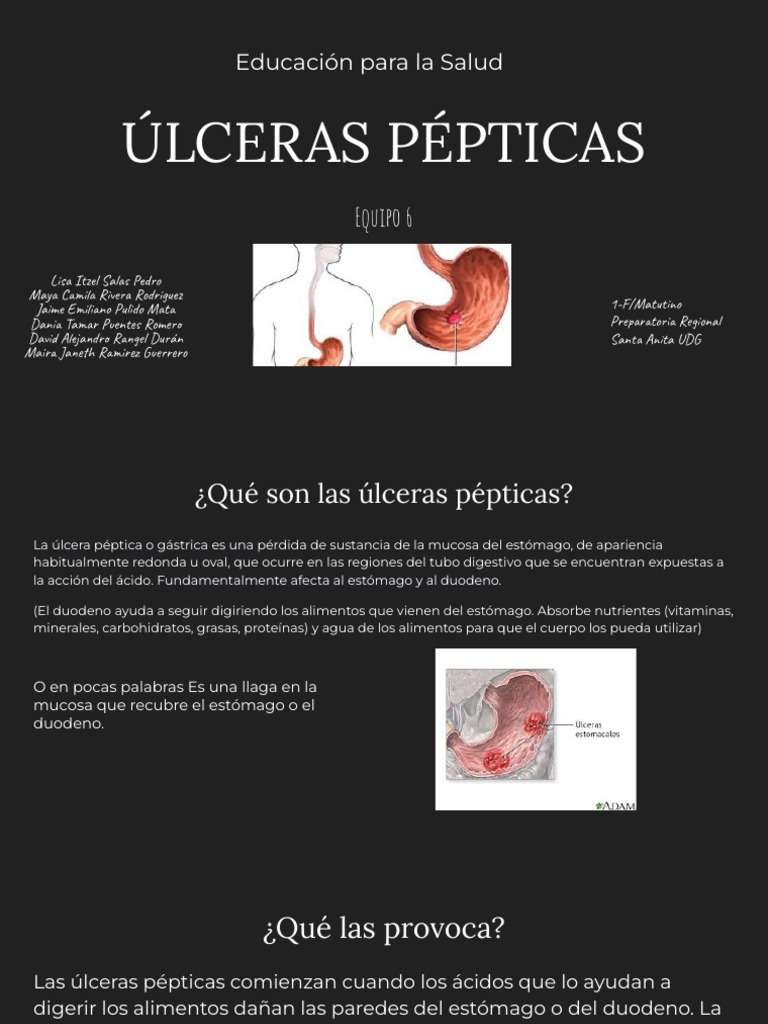 Úlceras Pépticas | PDF | Salud y bienestar