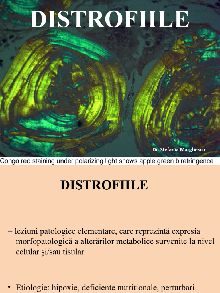 lp1 - Distrofii | PDF