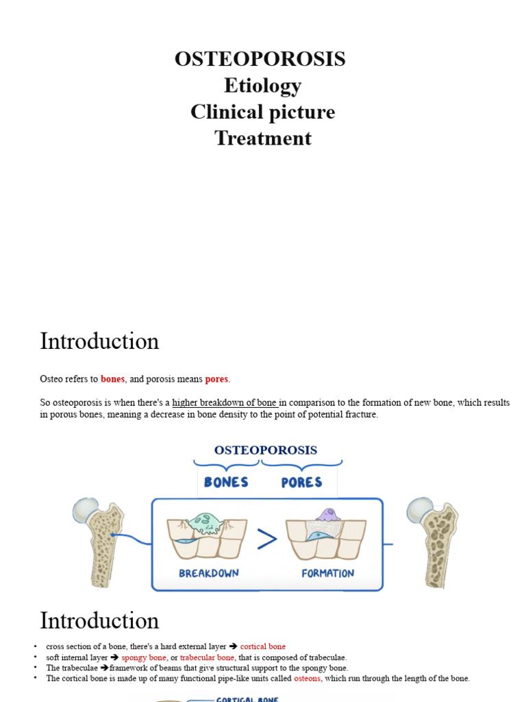 Osteoporosis Download Free Pdf Bone Osteoporosis