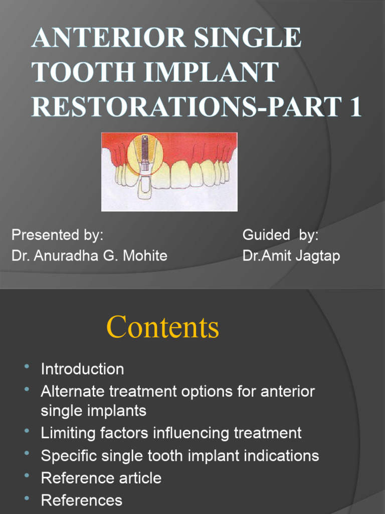 Anterior Single Tooth Implant Part1 | Download Free PDF | Dental ...