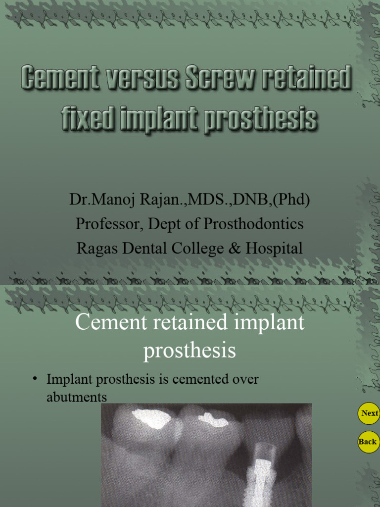 Cement Versus Screw Retained Implant Prostheses | PDF | Dental Implant ...