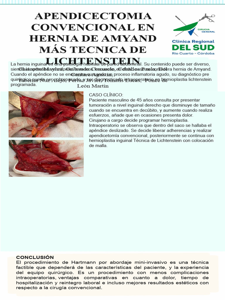 APENDICECTOMIA CONVENCIONAL EN HERNIA DE AMYAND MÁS TECNICA DE ...