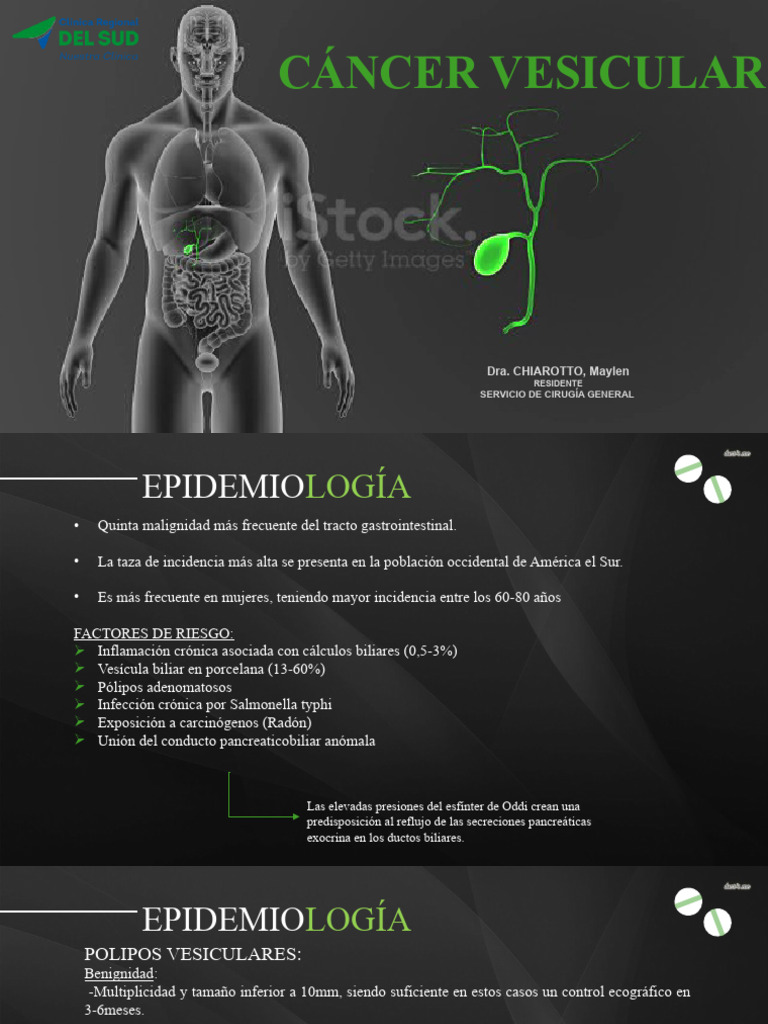 CANCER VESICULAR | Descargar gratis PDF | Cáncer | Metástasis