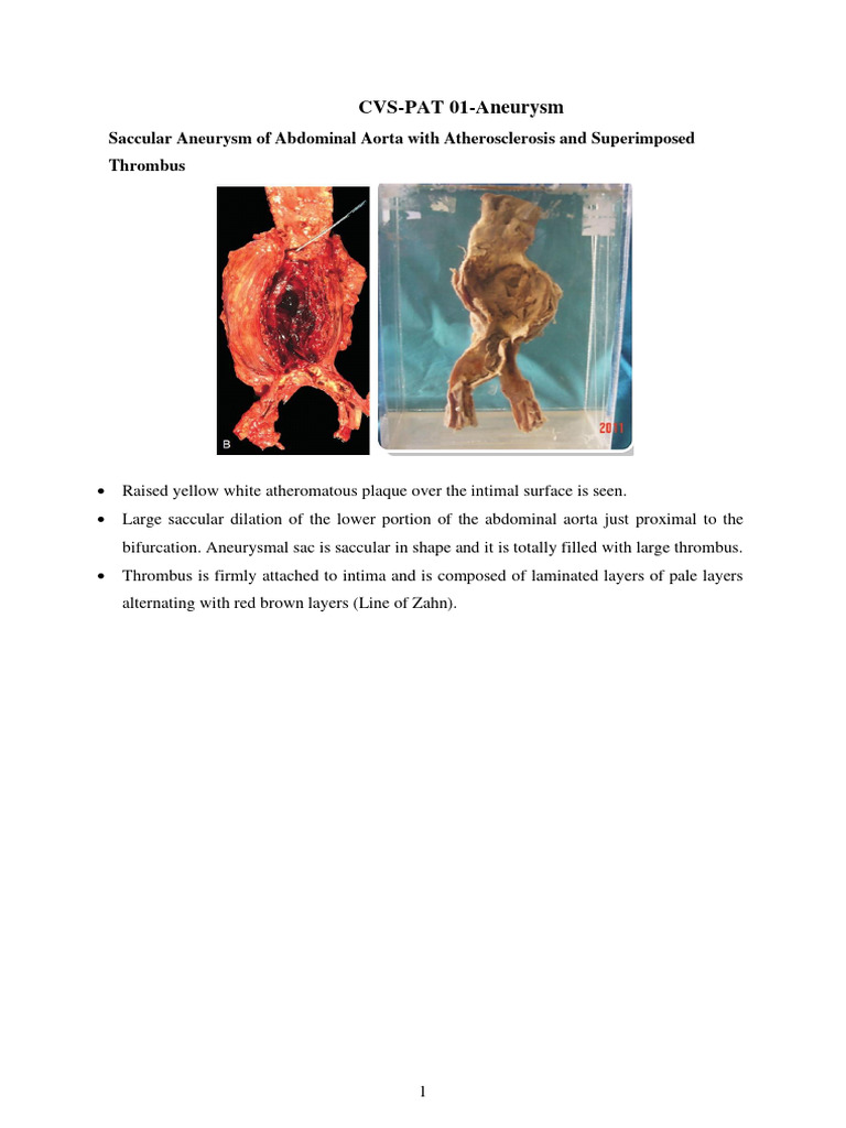 Cvs Module Practical | PDF | Cardiac Muscle | Heart Valve
