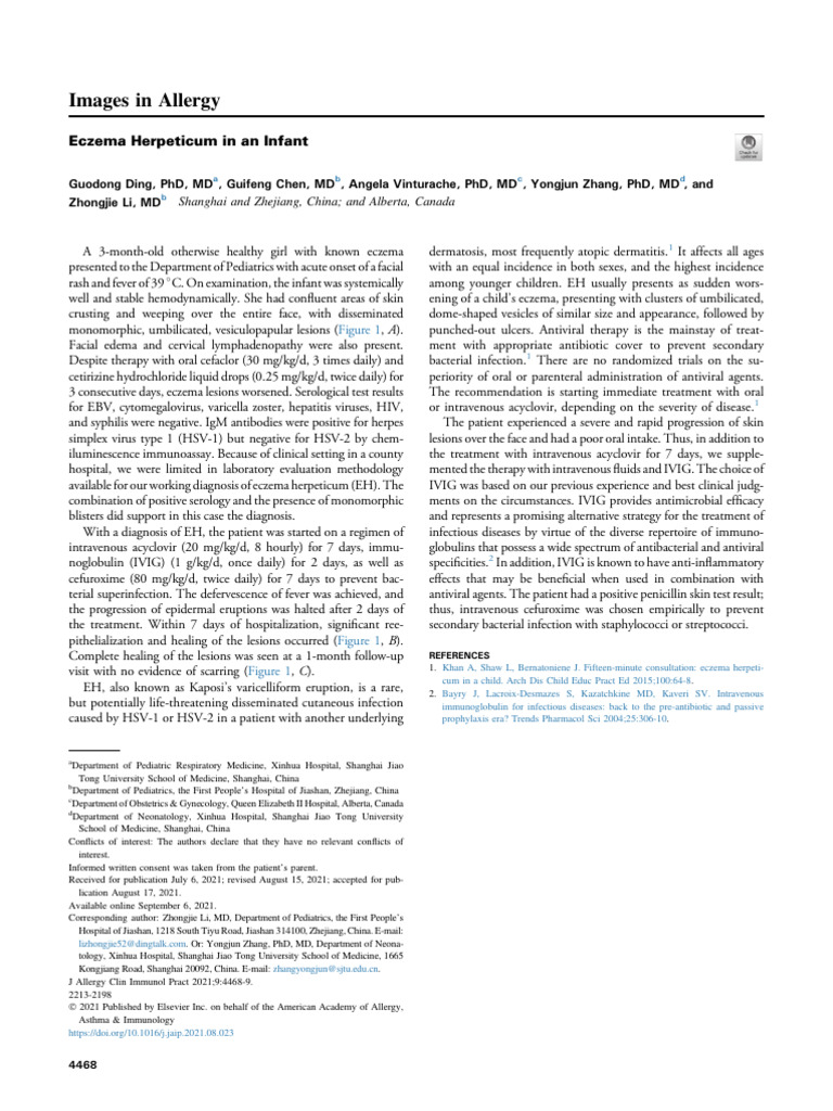 Eczema Herpeticum in An Infant - 2021 - Jaip | PDF | Dermatitis | Epidemiology