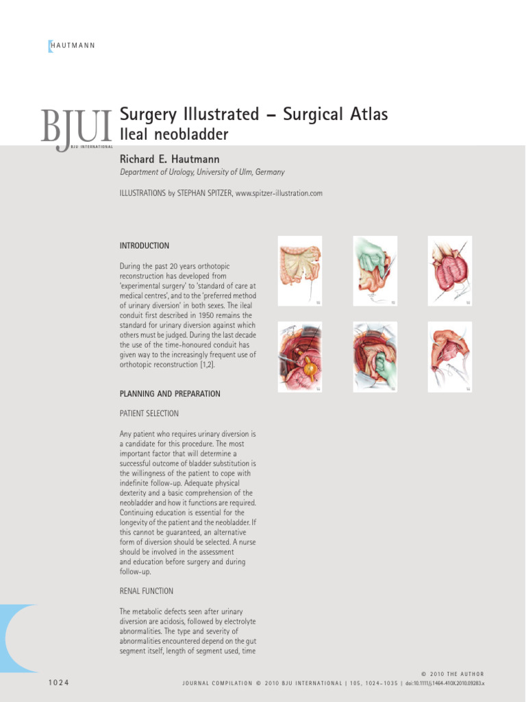 Ileal Neobladder Surgical Atlas Guide | PDF | Urinary Incontinence ...