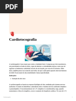 Cardiotocografia | PDF | Parto | Feto