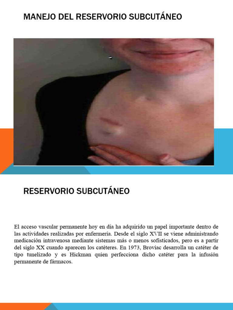 Manejo del Reservorio Subcutáneo | PDF | Terapia intravenosa | Medicina CLINICA