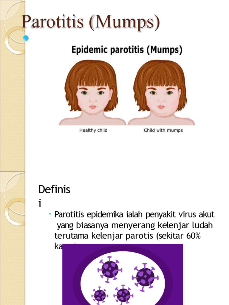 Parotitis Epidemika: Penyebab dan Gejala | PDF | Pengembangan Diri ...