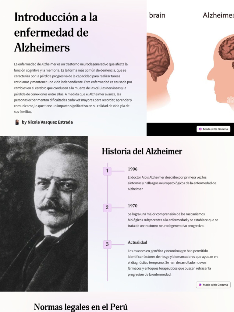 Guía Completa sobre Alzheimer | PDF | Enfermedad de Alzheimer | Demencia