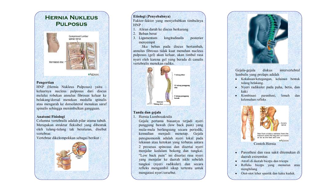 Leaflet Hernia Nukleus Pulposus | PDF