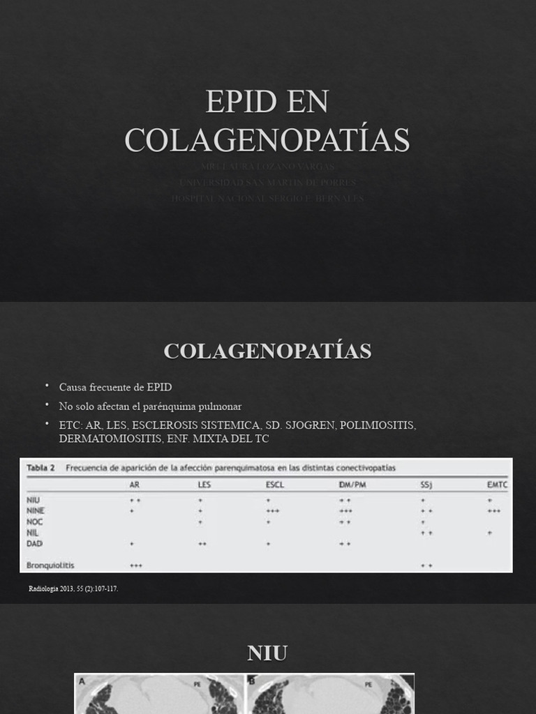 Epid en Colagenopatias | PDF