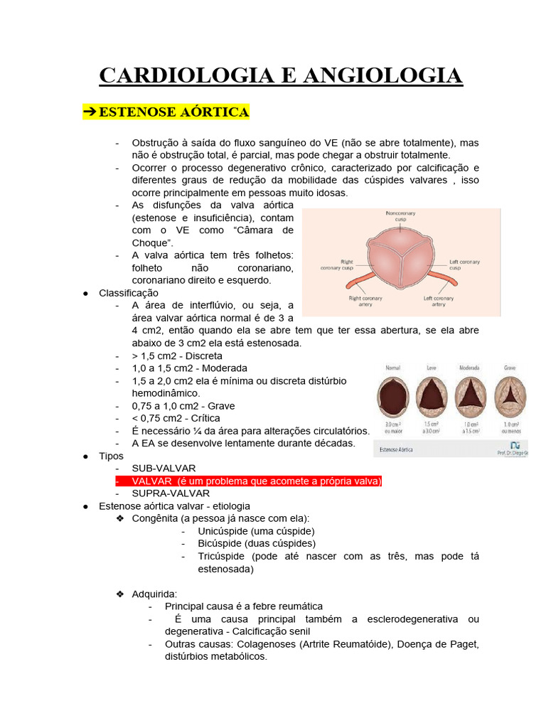 Estenose Aórtica: Causas e Tratamentos | PDF | Infarto do Miocárdio ...