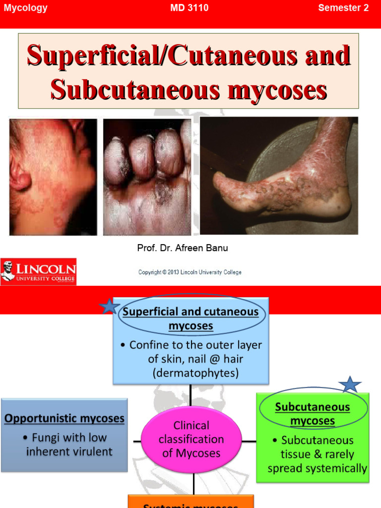 Lecture 2 Cutaneous and Subcutaneous Mycoses | PDF | Immunology ...