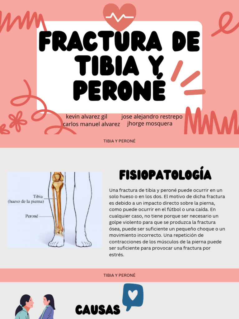 Fractura de Tibia y Perone (1) | Descargar gratis PDF | Hueso | Enfermedades y trastornos