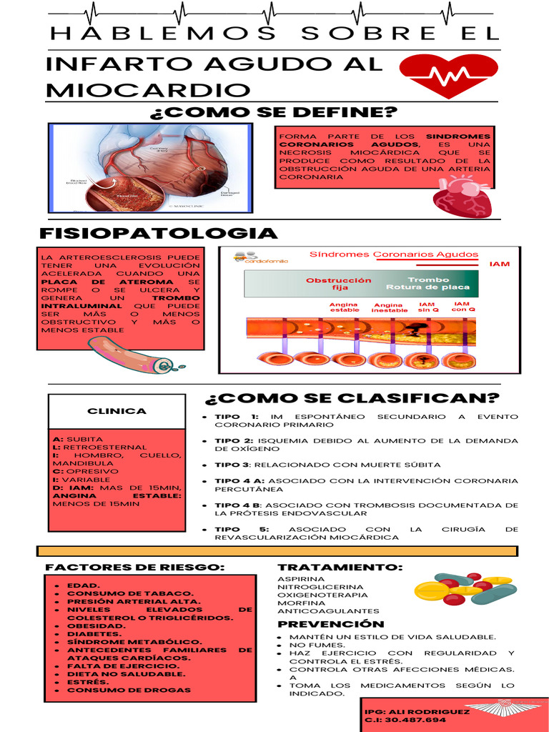Infarto Agudo de Miocardio: Guía Rápida | PDF | Infarto de miocardio ...