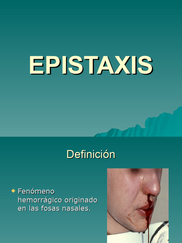Epistaxis | PDF | Medicina CLINICA | Especialidades Medicas