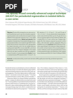 Miller Classification of Marginal Tissue | PDF | Periodontology ...