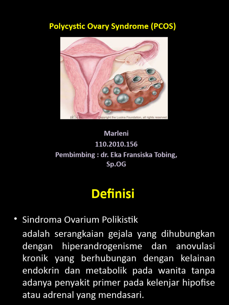 Pcos | PDF | Kesehatan Holistik