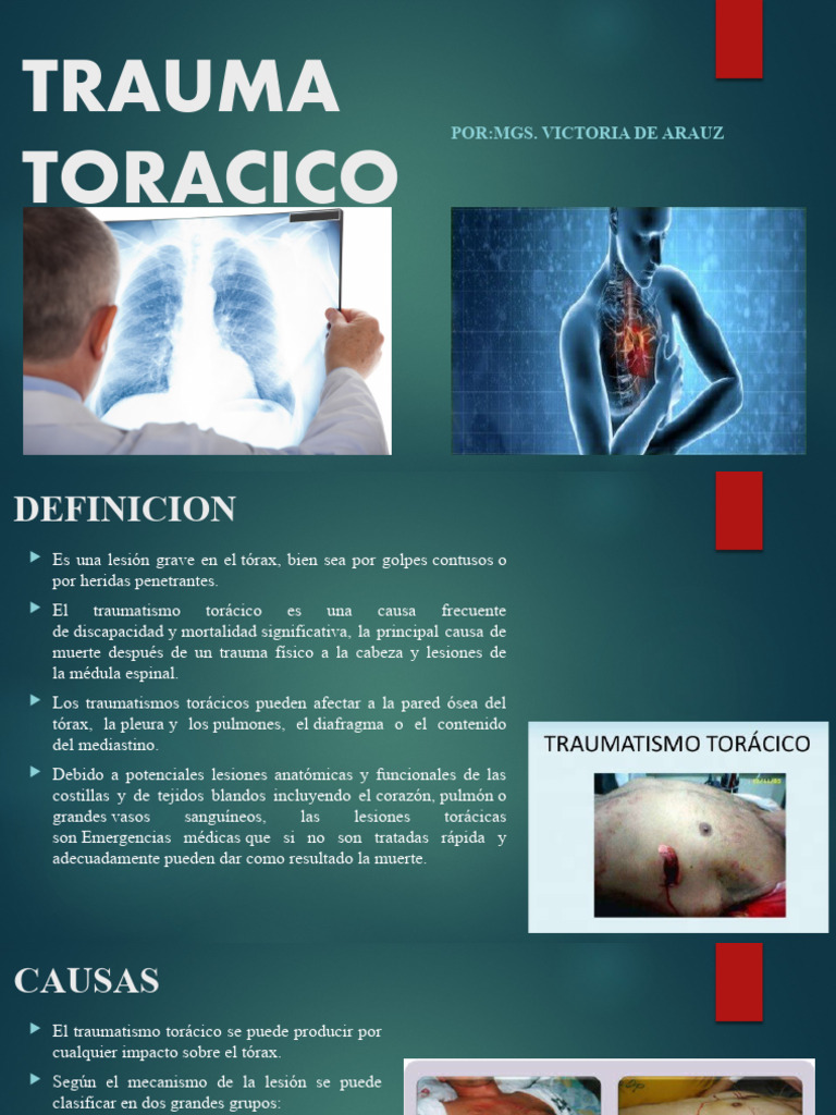 Trauma Toracico | PDF | Especialidades Medicas | Emergencias Médicas