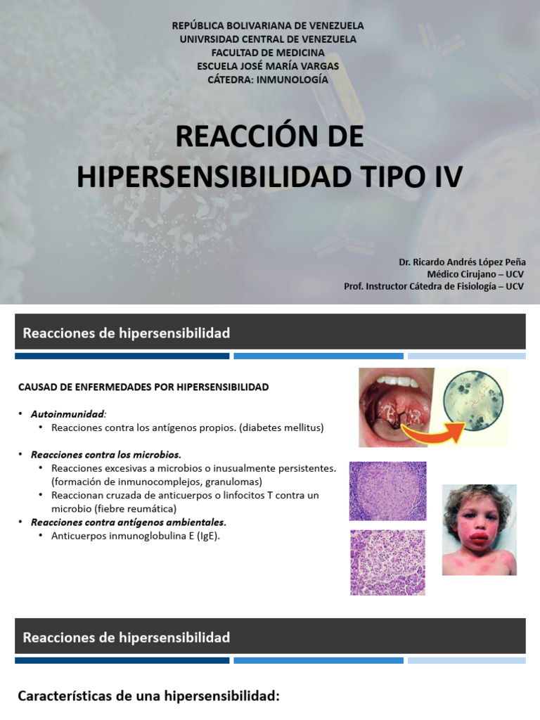 Tema 20 Hipersensibilidad Tipo IV R Lopez 2023 | PDF | Tuberculosis ...