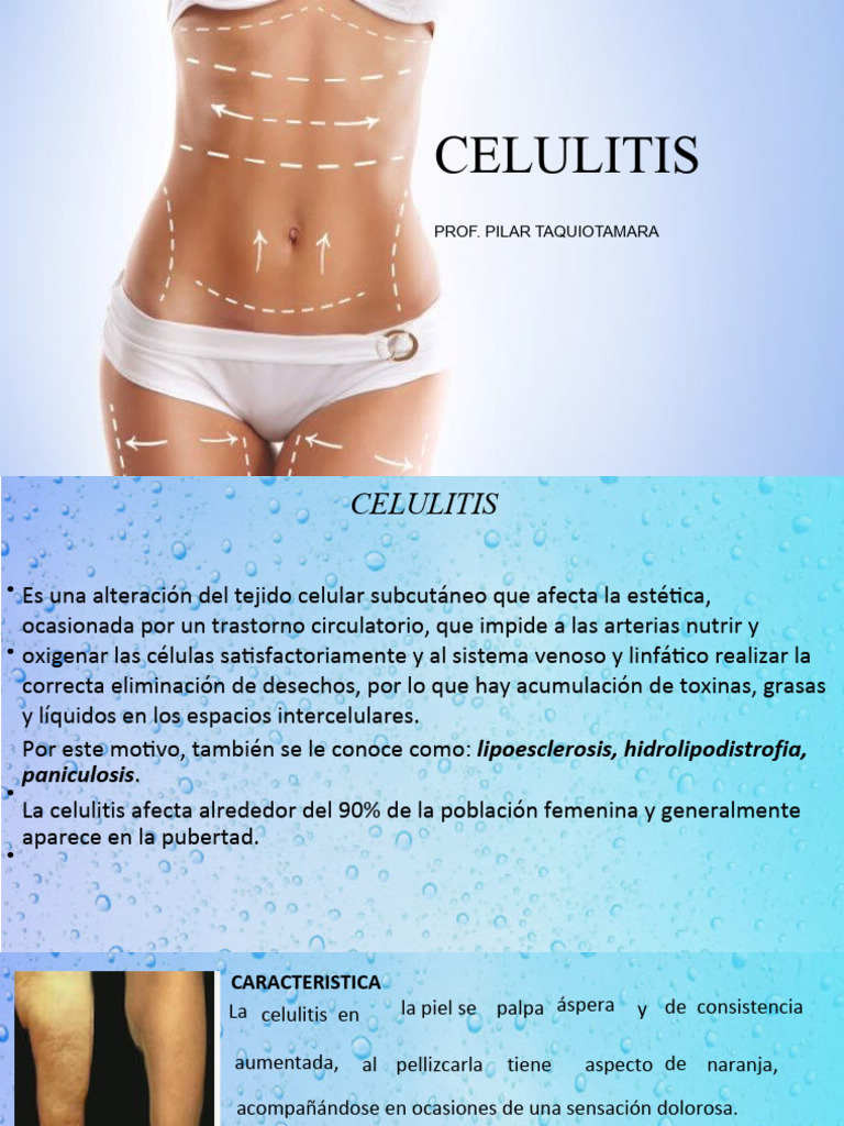 CELULITIS | PDF | Sistema circulatorio | Sistema linfático