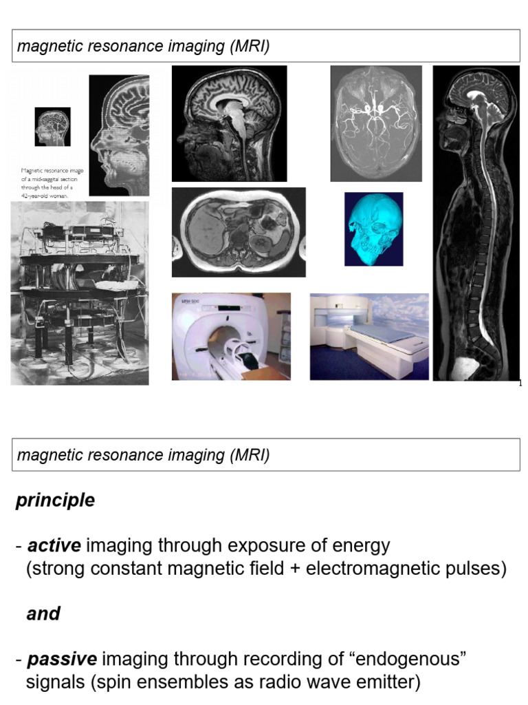 07 Mri | PDF | Relaxation (Nmr) | Nuclear Magnetic Resonance