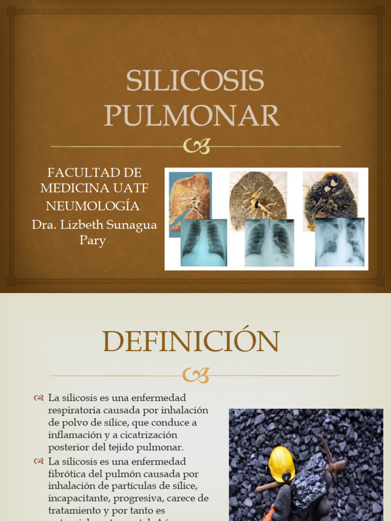 Silicosis Pulmonar | PDF | Medicina | Medicina CLINICA