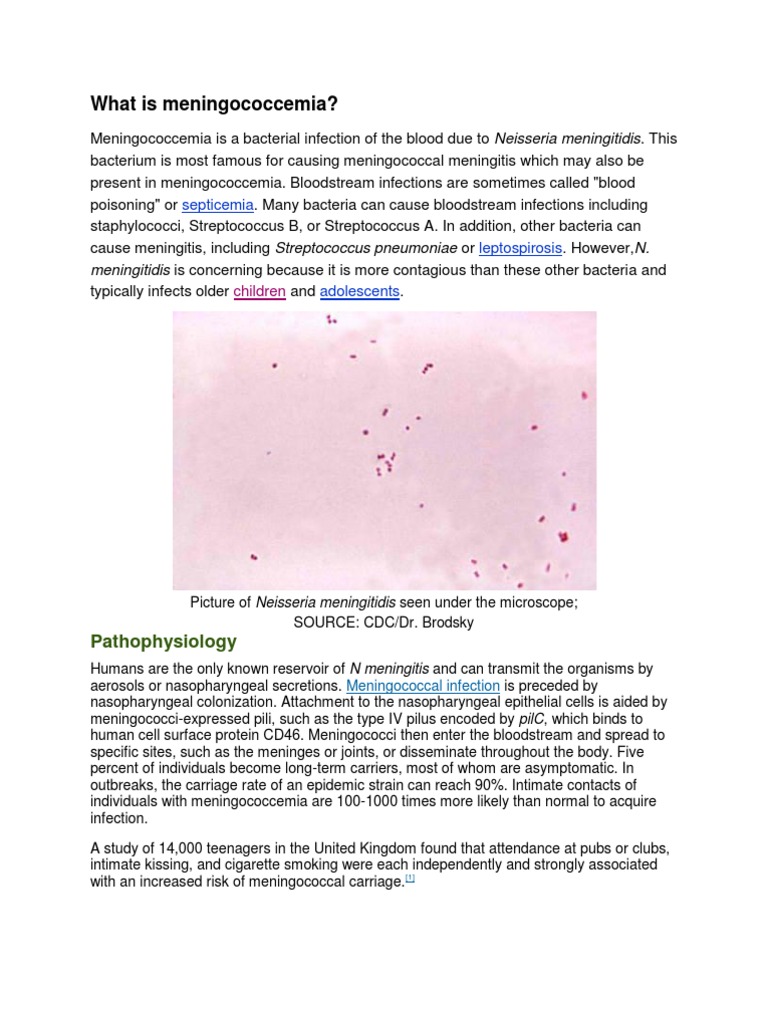 meningococcemia | Meningitis | Health Sciences