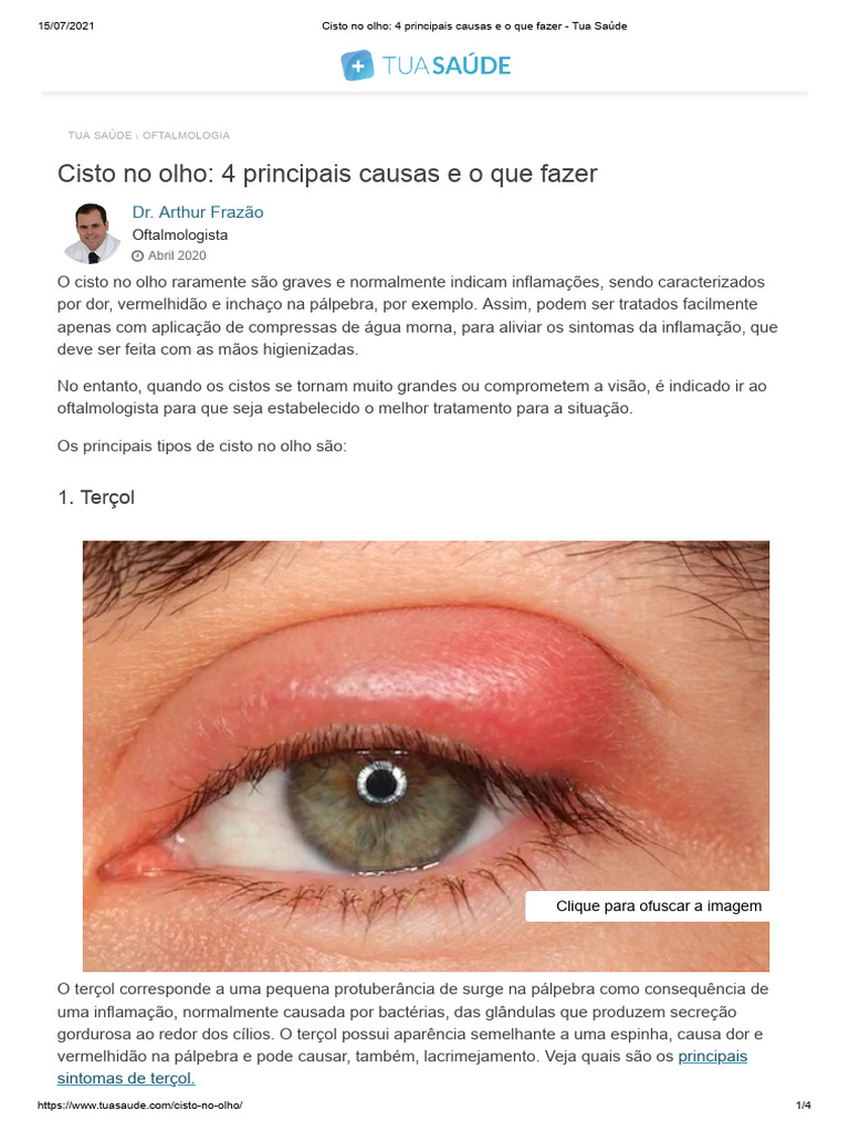 Cisto No Olho - 4 Principais Causas e o Que Fazer - Tua Saúde | PDF ...