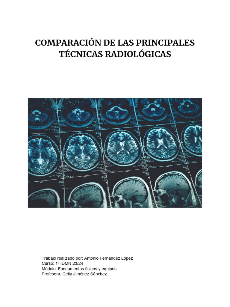 Trabajo FFE Subida de Nota | PDF | Ct Scan | Ultrasonido