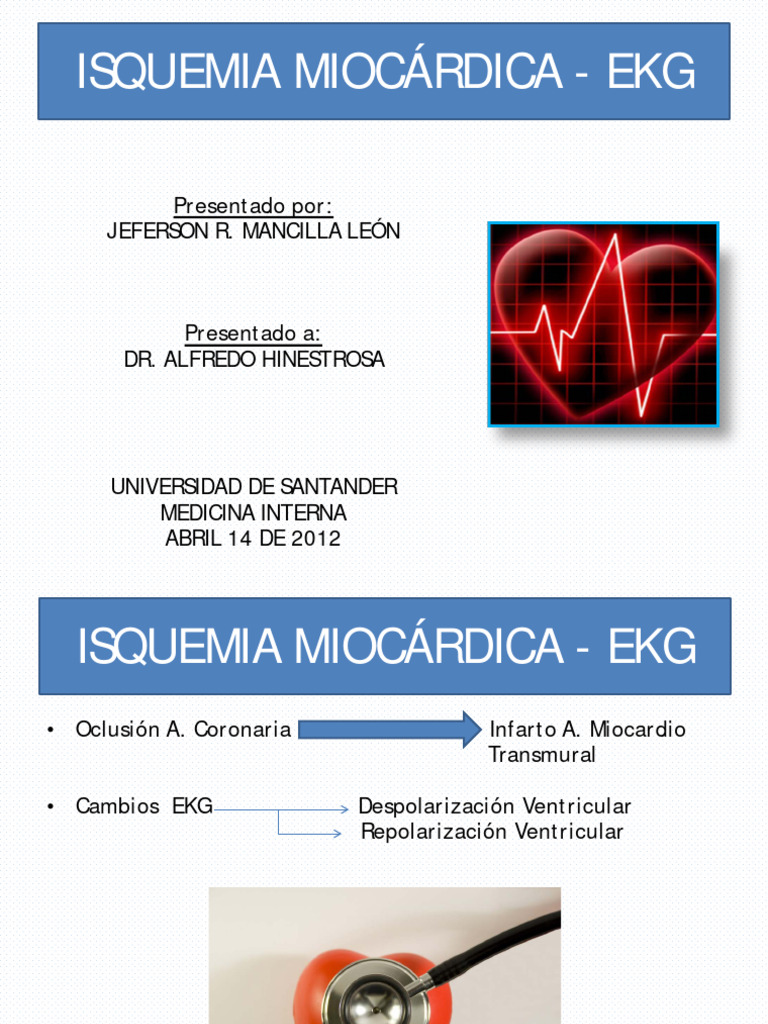 IMA EXP | Descargar gratis PDF | Electrocardiografia | Infarto de miocardio