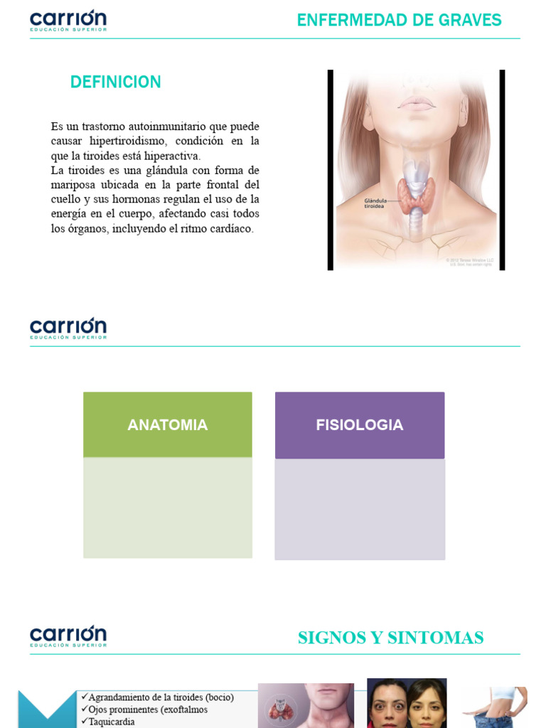 Enfermedad de Graves: Síntomas y Tratamiento | PDF | Hipertiroidismo ...