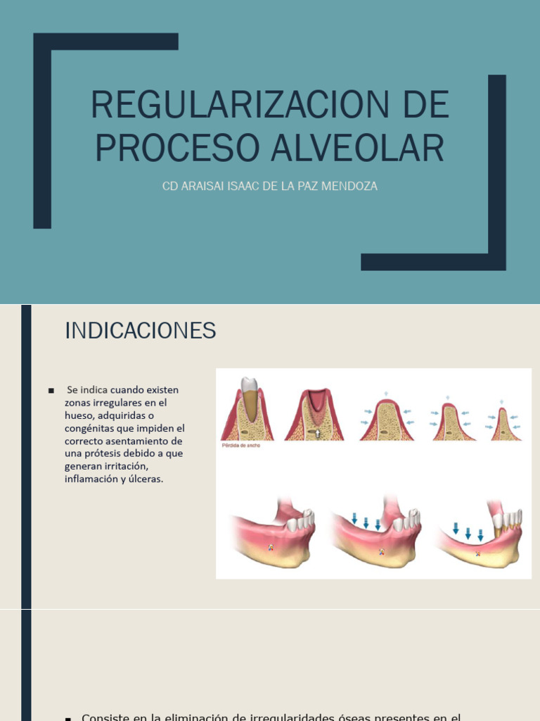 Regularizacion de Proceso Alveolar | PDF | Ciencia y matemáticas ...