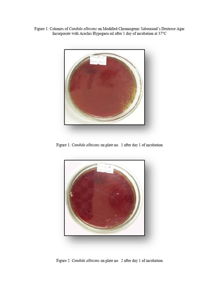 Candida Albicans Day 1 To 4 | Download Free PDF | Mycology | Microbiology