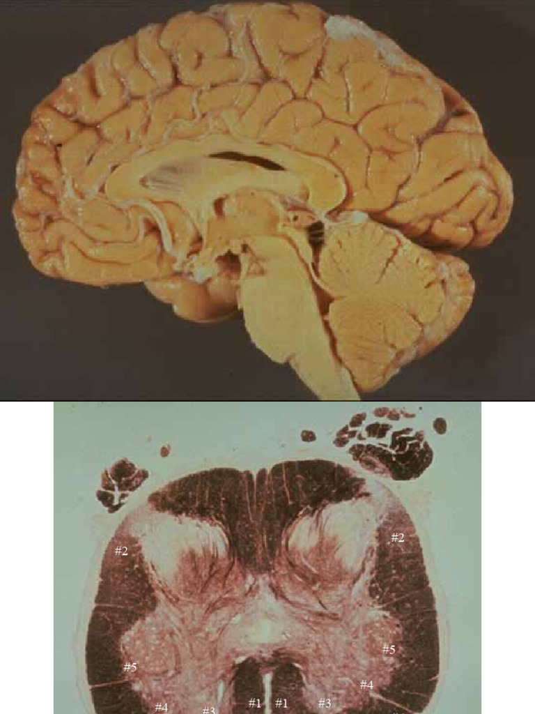 Repeated Number Patterns Document | PDF